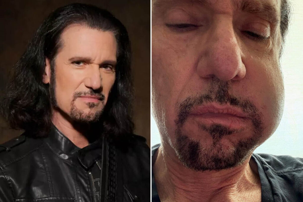 Bruce Kulick Breaks Silence After Swollen Face Sparks Health Concerns