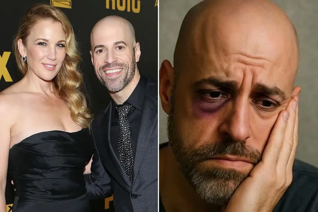 Chris Daughtry Responds to Reports of Him Getting a Black Eye After ...
